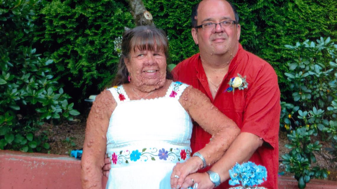 Tim and Gail over the years | thv11.com