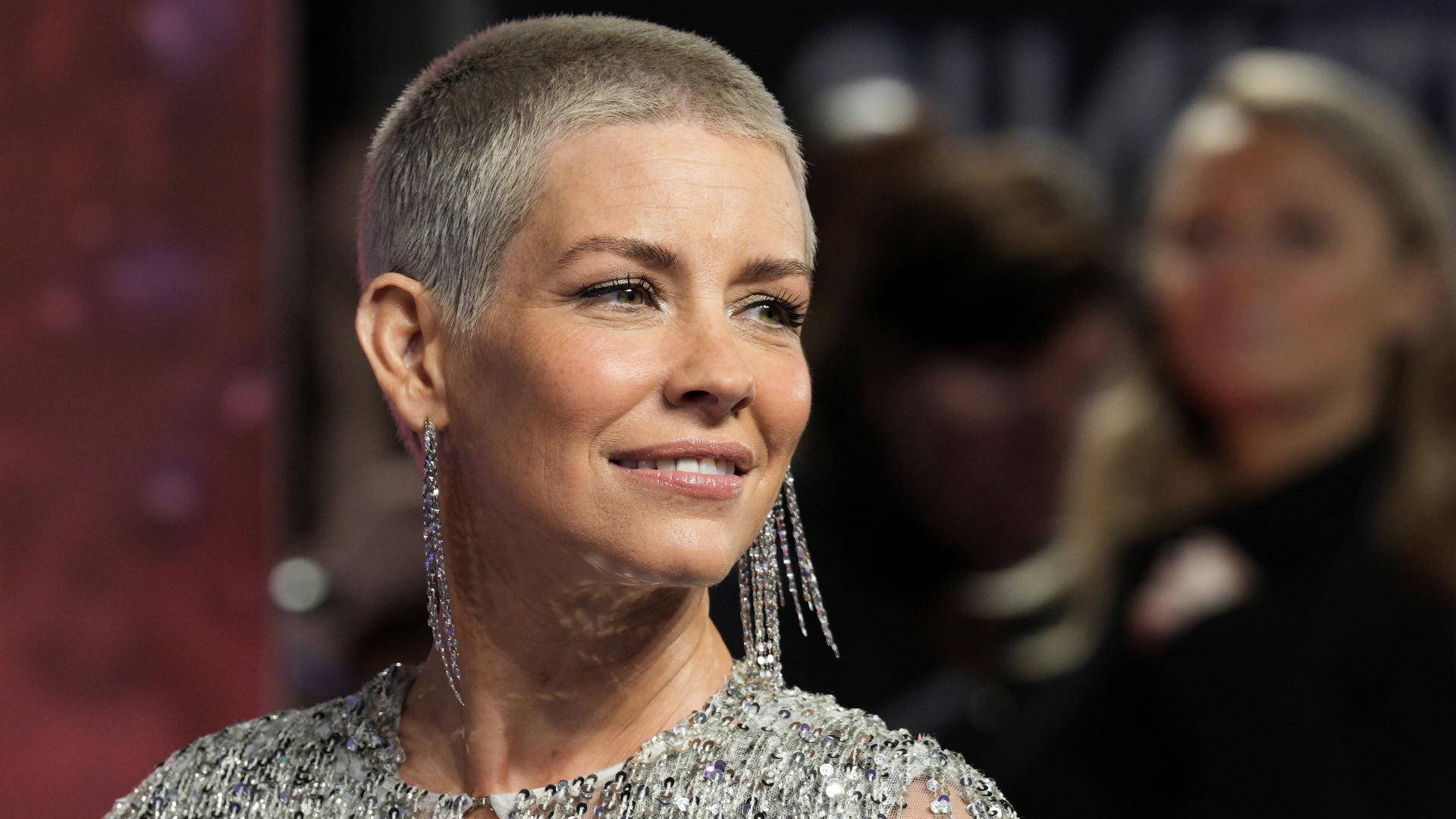 Actress Evangeline Lilly says she has brain damage after traumatic fall ...