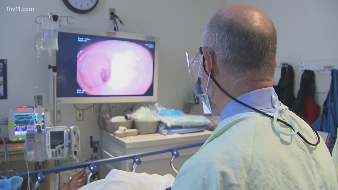 New report shows colon cancer hitting younger adults more | thv11.com