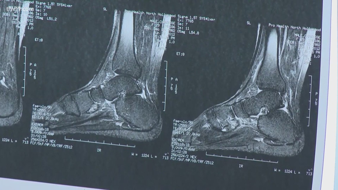 Shoes with support from hind foot to mid foot is a great start to ...