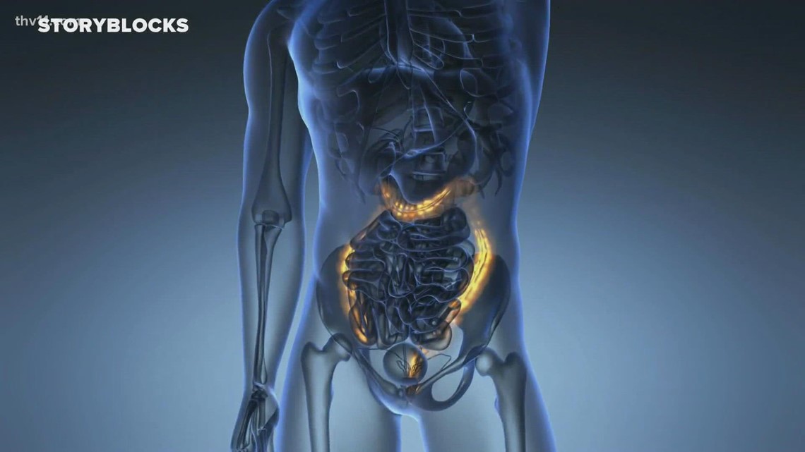 Importance of a colonoscopy | Wear the Gown | thv11.com