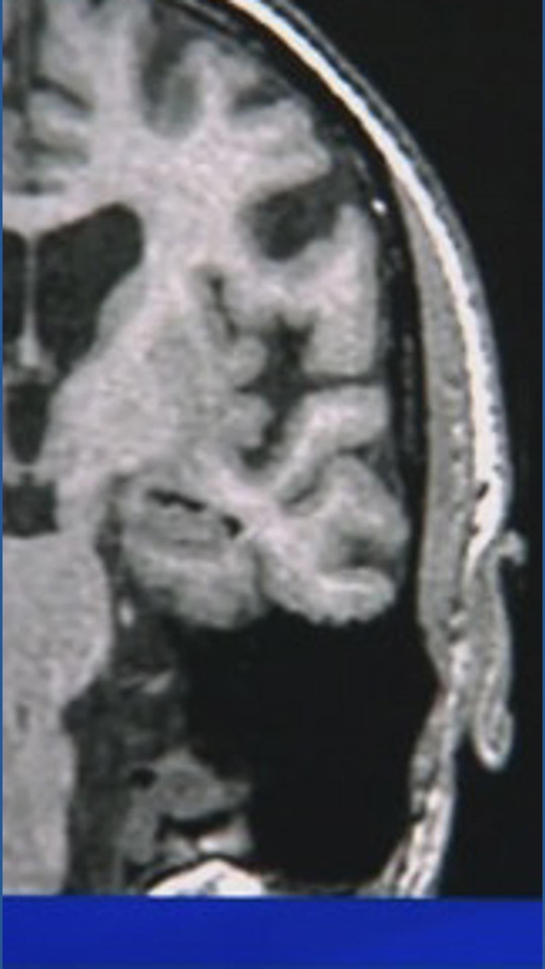 Ten healthy habits to help your brain | Health Minute | thv11.com