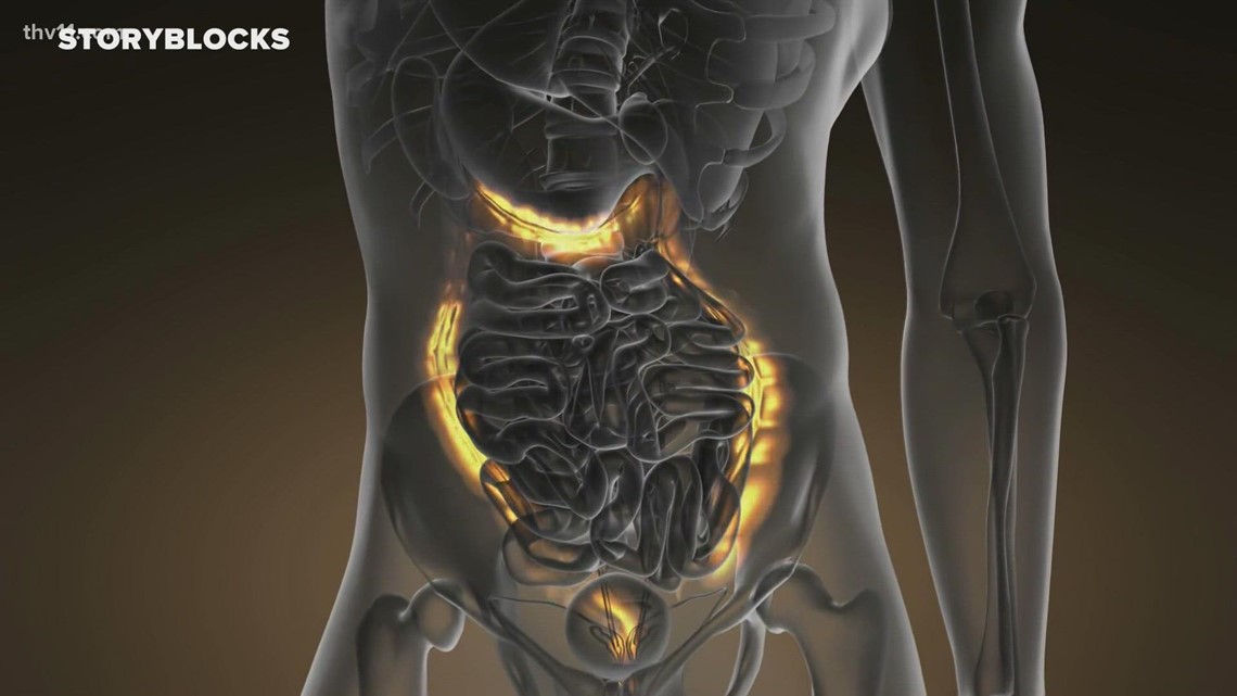 The vital importance of a colonoscopy | Wear the Gown | thv11.com