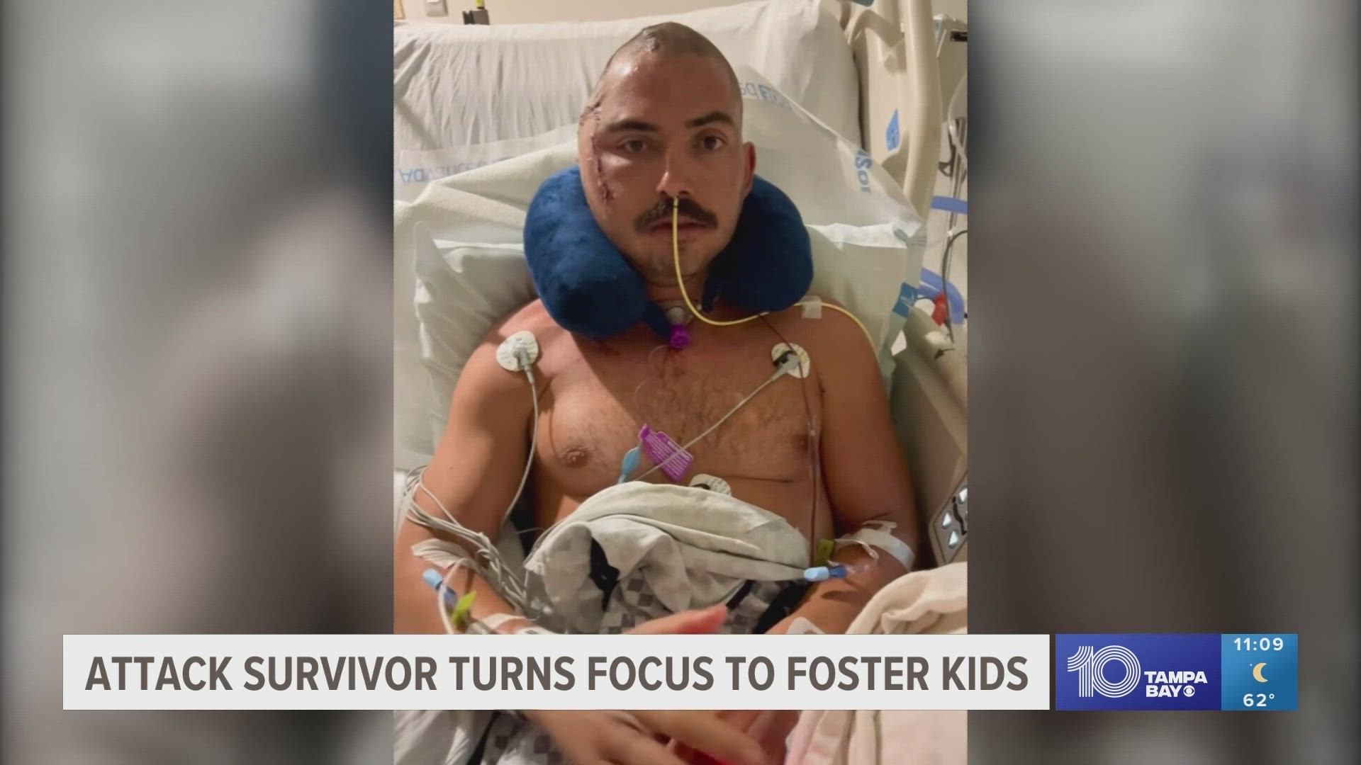 Florida man survives alligator attack, starts foundation | thv11.com